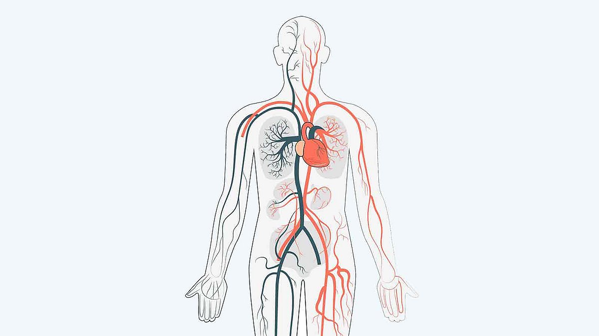 Kranke Aorta … und nun? - Herzchirurgie | Uniklinikum Erlangen